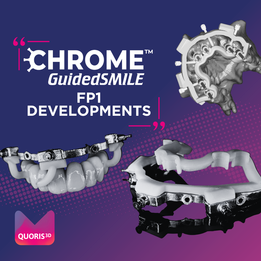 FP1 Developments: Key Enhancements to GuidedSMILE Natural a Potential ...