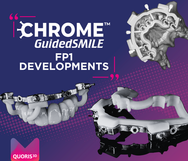 FP1 Developments: Key Enhancements to GuidedSMILE Natural a Potential ...