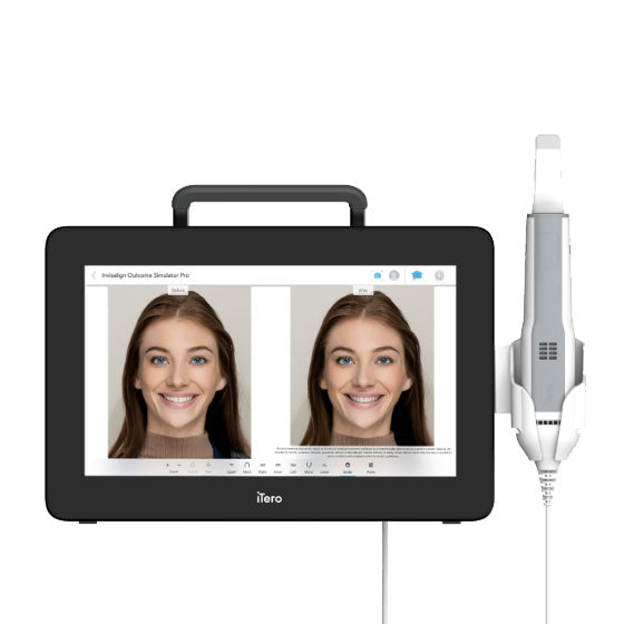 Itero Restorative Packages – Quoris3D