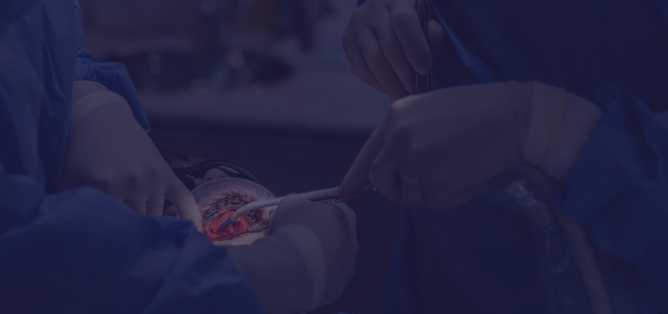 Get Started with CHROME – Quoris3D