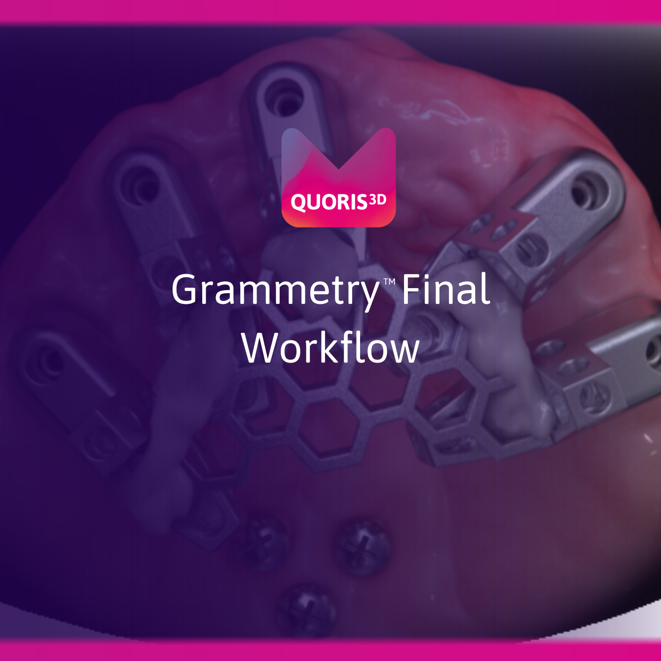 Grammetry Workflows – Quoris3D