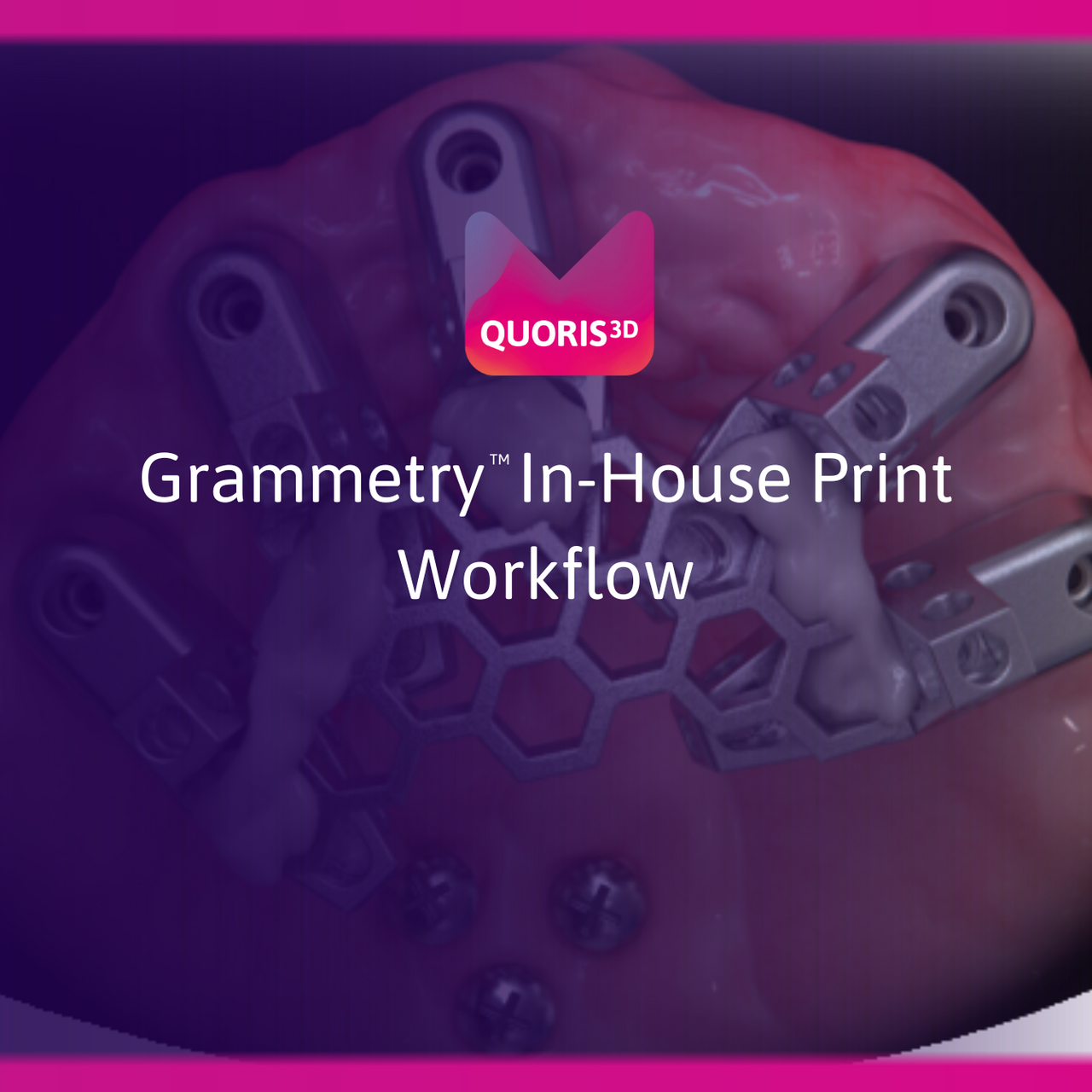 Grammetry Workflows – Quoris3D