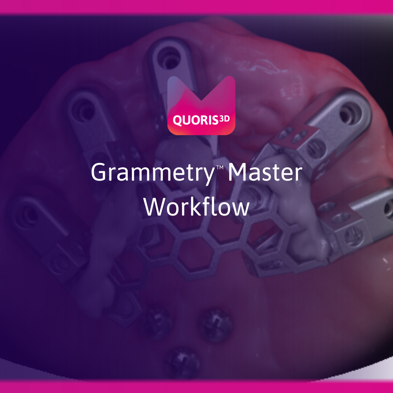 Grammetry Workflows – Quoris3D