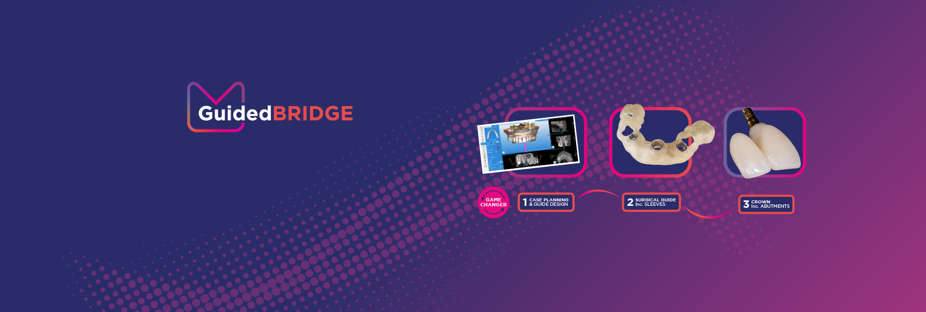 Guided Bridge – Quoris3D