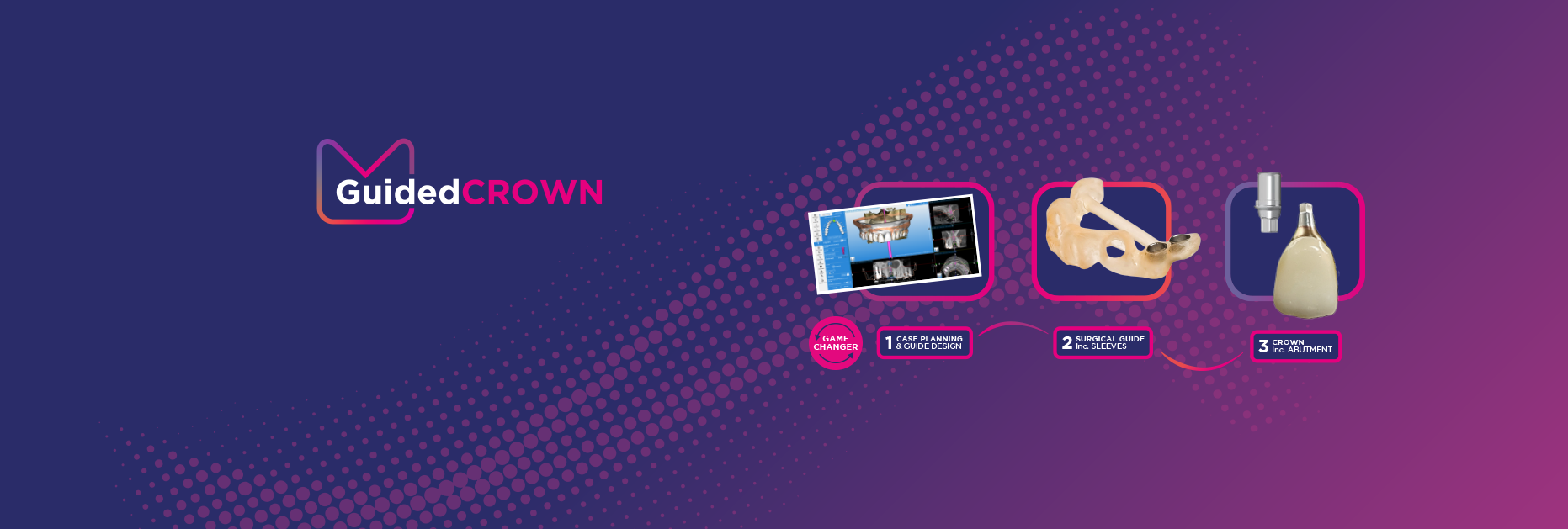 Guided Crown – Quoris3D