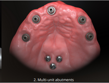 Grammetry – Quoris3D