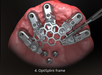 Grammetry – Quoris3D