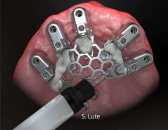 Grammetry – Quoris3D