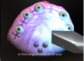 Grammetry – Quoris3D