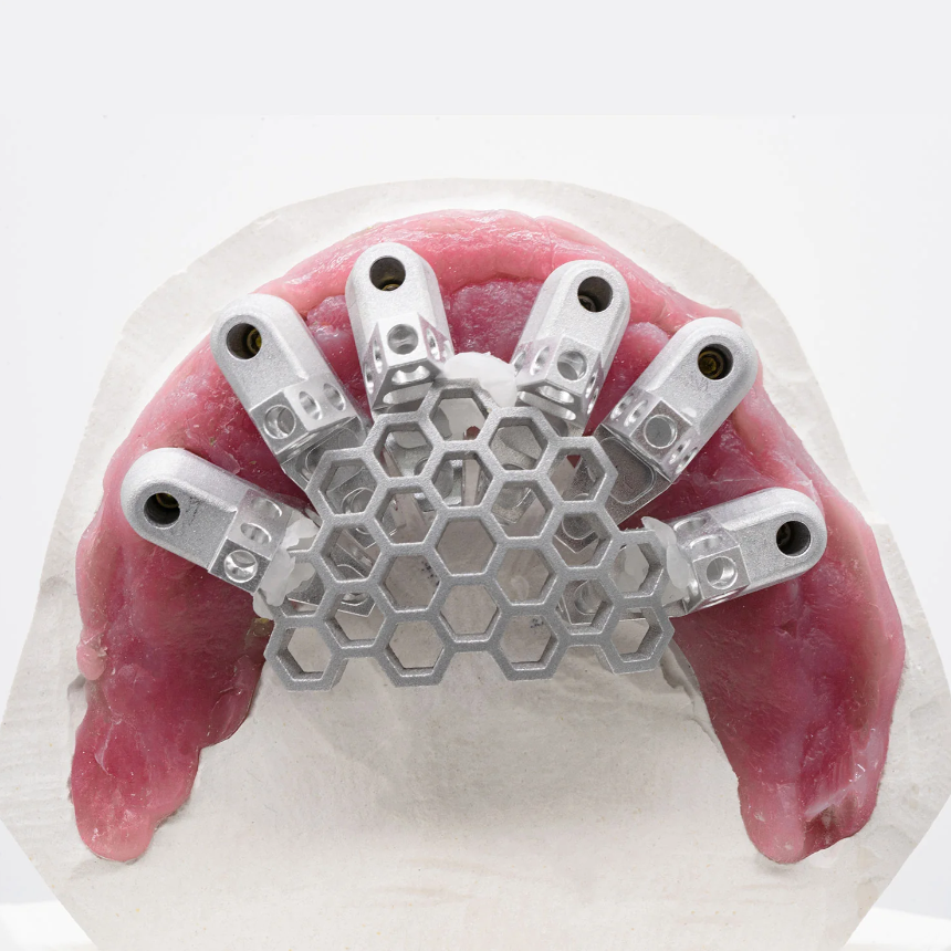 GuidedSMILE Grammetry – Quoris3D